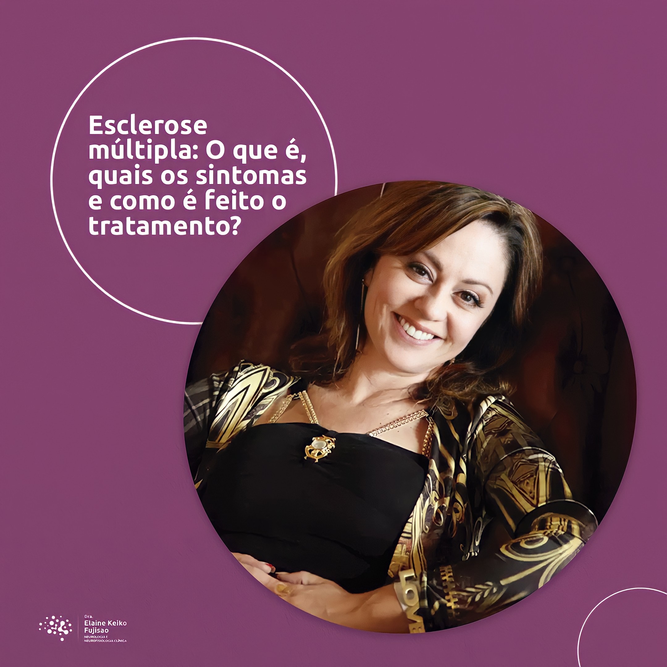 Esclerose Múltipla: o que é, quais os sintomas e como é feito o ...